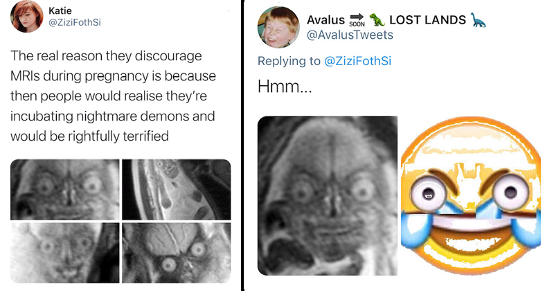 Cursed Thread Reveals the Nightmare of Fetal MRIs - Memebase - Funny Memes
