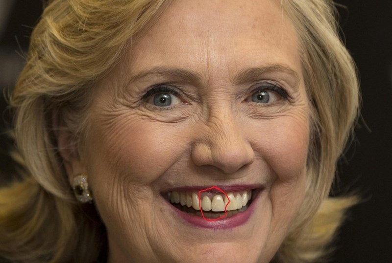 Check Up of the Day: Dentist Gives a Run Down on Presidential ...