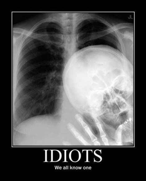 Very Demotivational - x ray - Very Demotivational Posters - Start Your ...